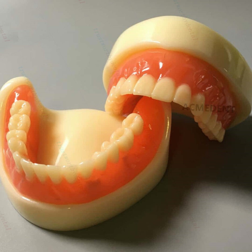 Dental Full Denture Model Overdenture Magnetic Attachment Mandibular ...