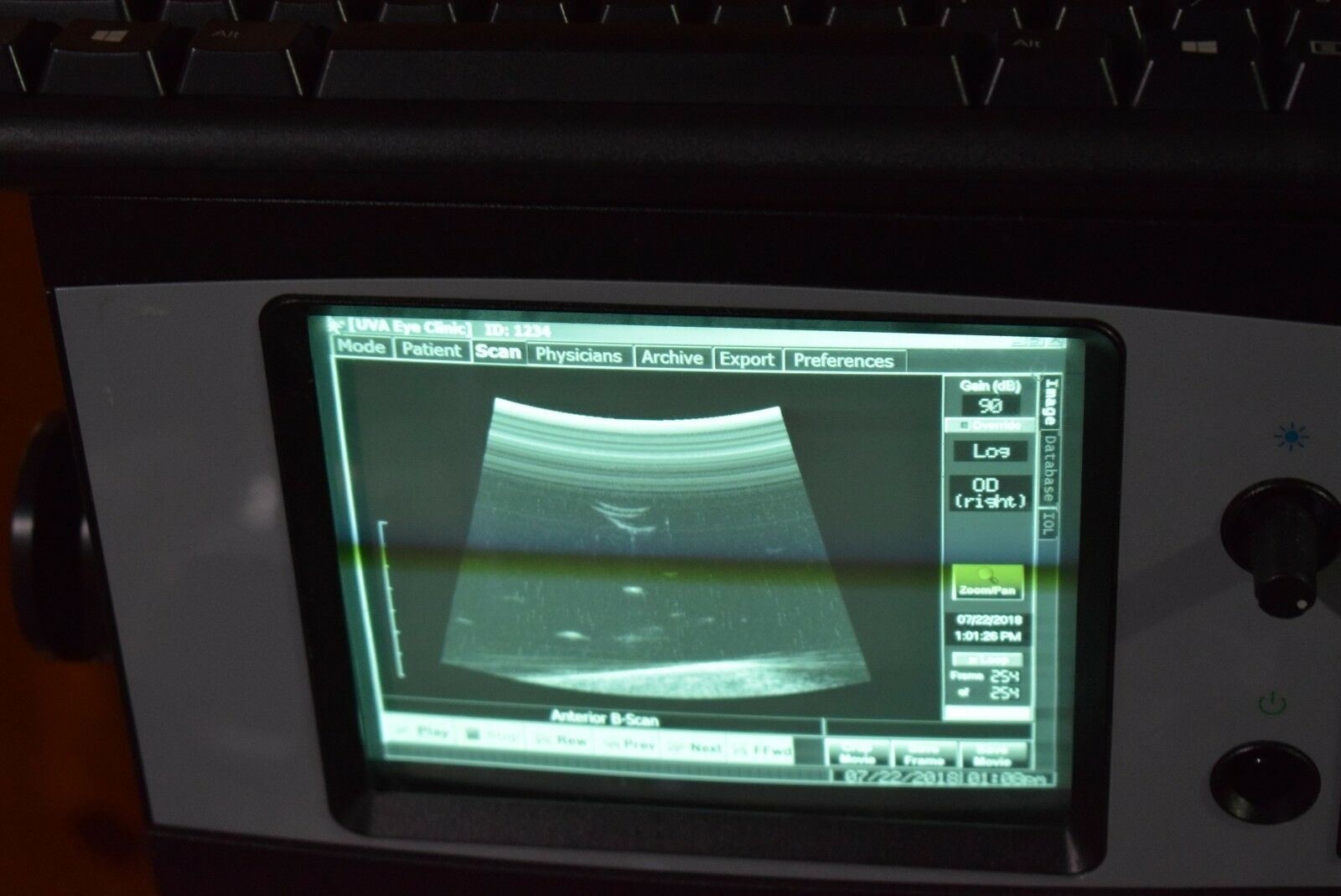 Ellex Eyecubed ultrasound biomicroscopy (UBM) unit | eBay