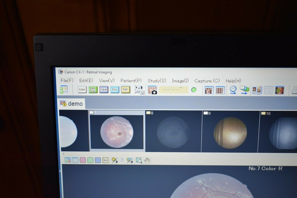 Canon CX-1 Fundus retinal camera non-myd/mydriatic FAF Fluorescein FFA ...