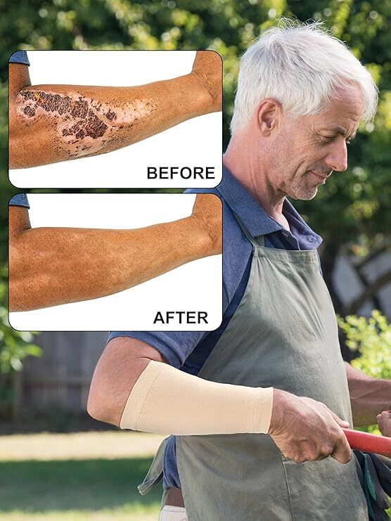 9 Pairs Elderly Skin Protector Sleeves Thin Skin Arm Sleeve Bruise ...