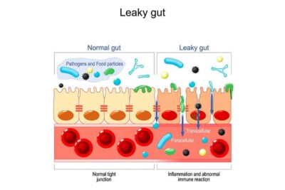 Cells On Gut Lining Held Tightly Together Limited Edition Premium ...