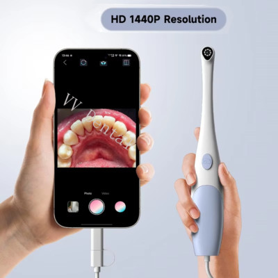 Dental USB Intraoral Camera Wireless Oral Endoscope LED 480P/1440P ...