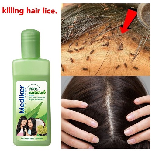 Mediker Anti-Lice Treatment Shampoo, 50 ml, Painless and natural lice ...