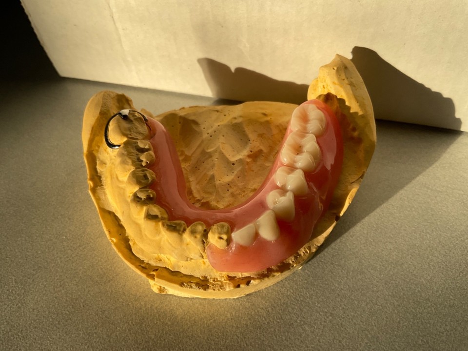 Vintage Lower Partial (False Teeth) Acrylic on model display ~ Dental ...