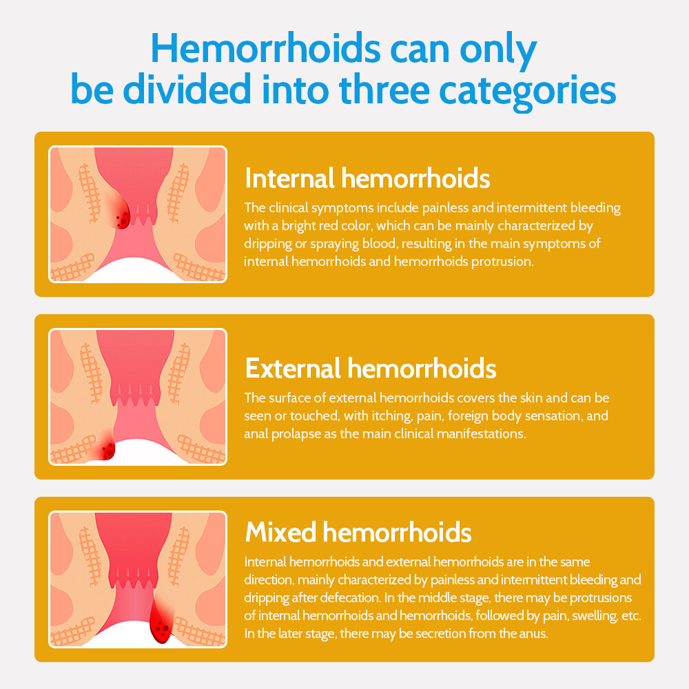 Hemorrhoids Remove Ointment Herbal Cream Relief Piles Pain Reduce ...
