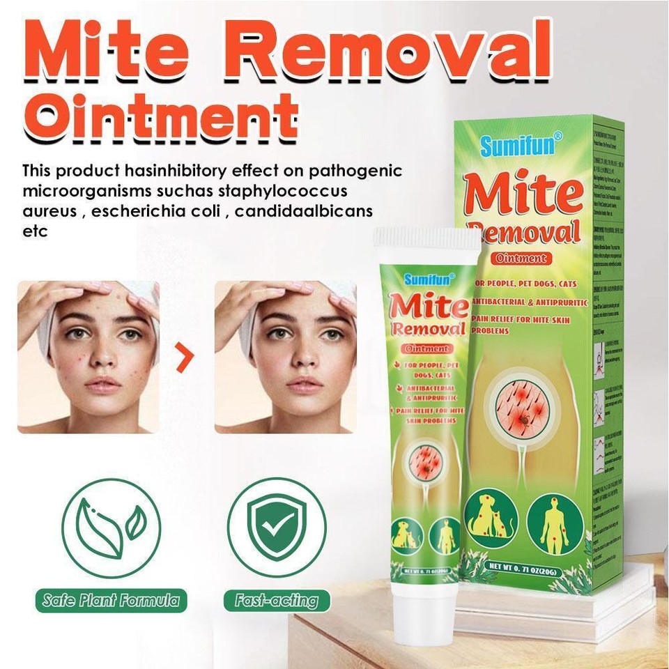 20g Mite Removal Ointments Anti Itching Scabies Kill Lice NEW Head Care ...