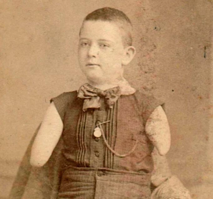 Human Deformities Sideshow