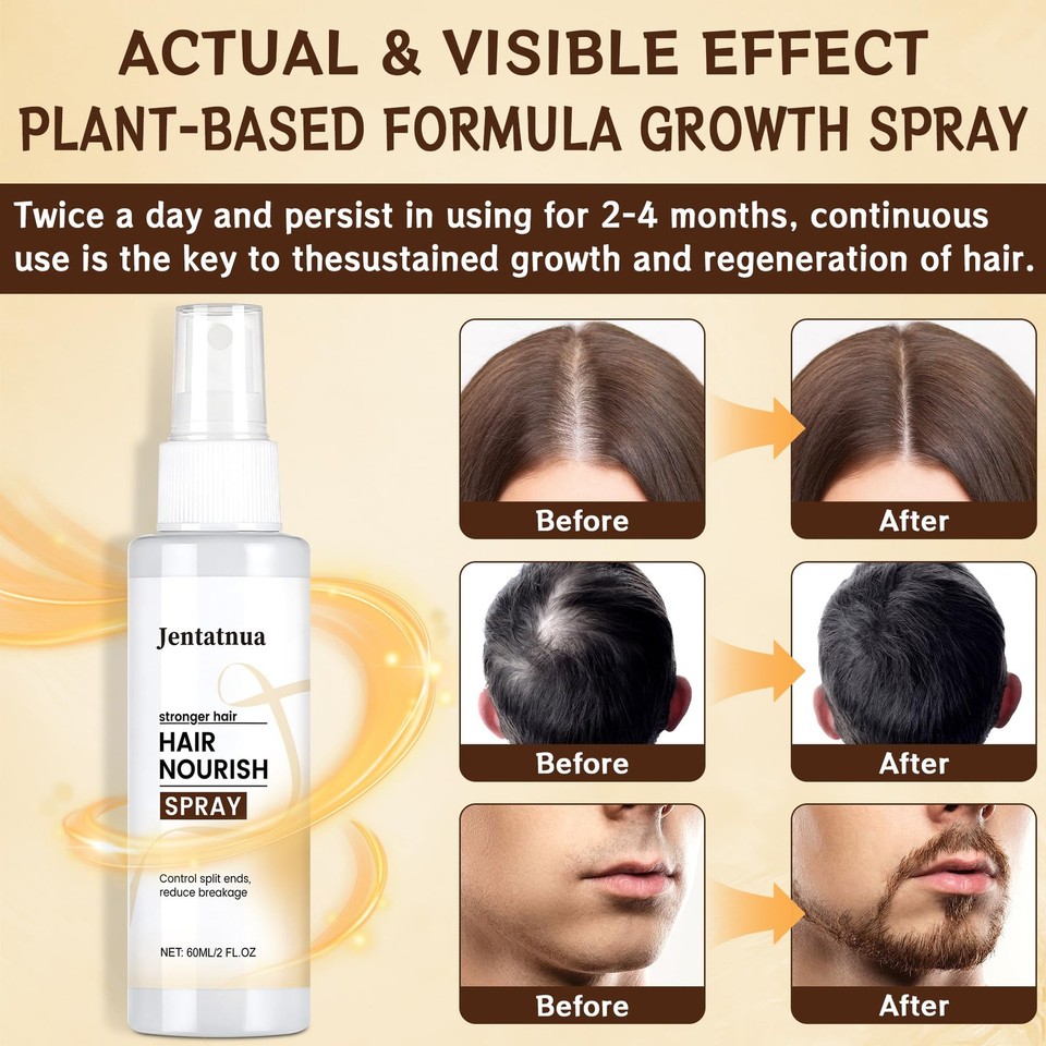 Hair Growth Spray, Natural Hair Growth Serum for Women With Rosemary ...