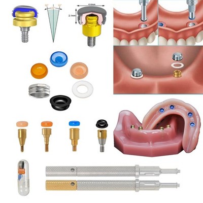 Dental Overdenture Locator Implant Male Cap Retention Inserts Kit PEEK ...