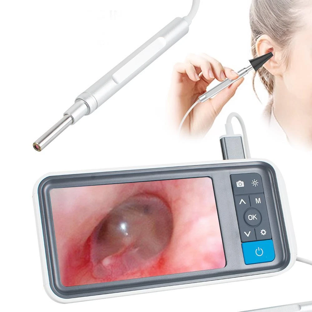 Otoscope View Ear Wax