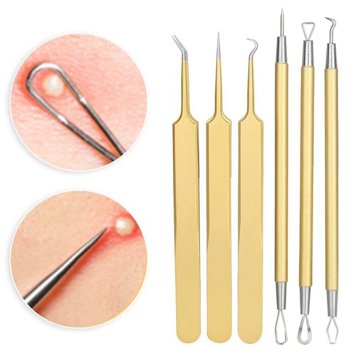 6pcs Blackhead Acne Clip Needle Tweezers Pimple Extractor Remover Tool ...