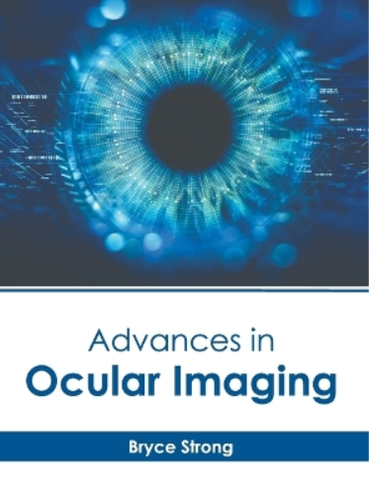 Bryce Strong Advances in Ocular Imaging (Relié) | eBay