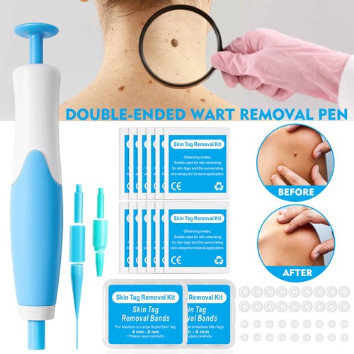 2-8mm Double Ended Wart Painless Removal Pen Micro Skin Tag Remover ...
