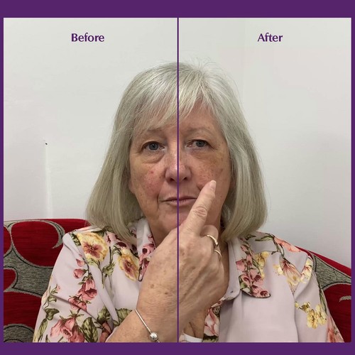 Beverly Hills V-Lift Instant Facelift & Under Eye Tuck 30ml (1 fl oz ...