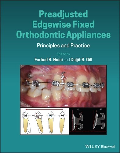 Daljit S. Gill Preadjusted Edgewise Fixed Orthodontic App (Hardback ...