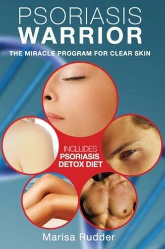 Psoriasis Warrior: The Miracle Program for Clear skin by Marissa Rudder ...