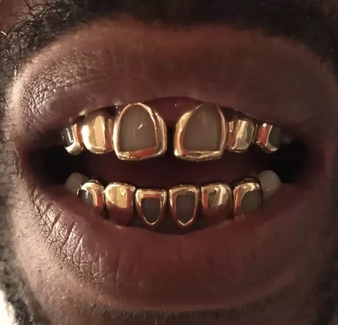 Gold Grill Tumblr
