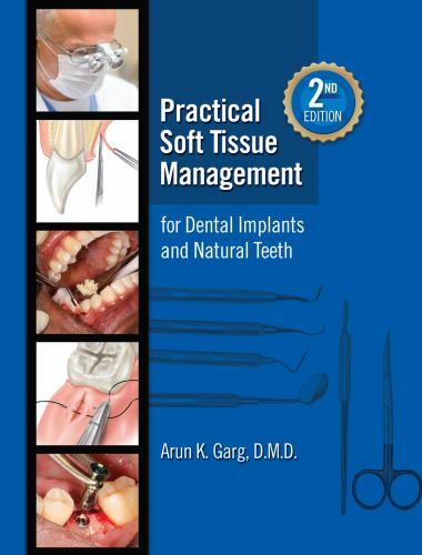 Practical Soft Tissue Management : For Dental Implants and Natural ...