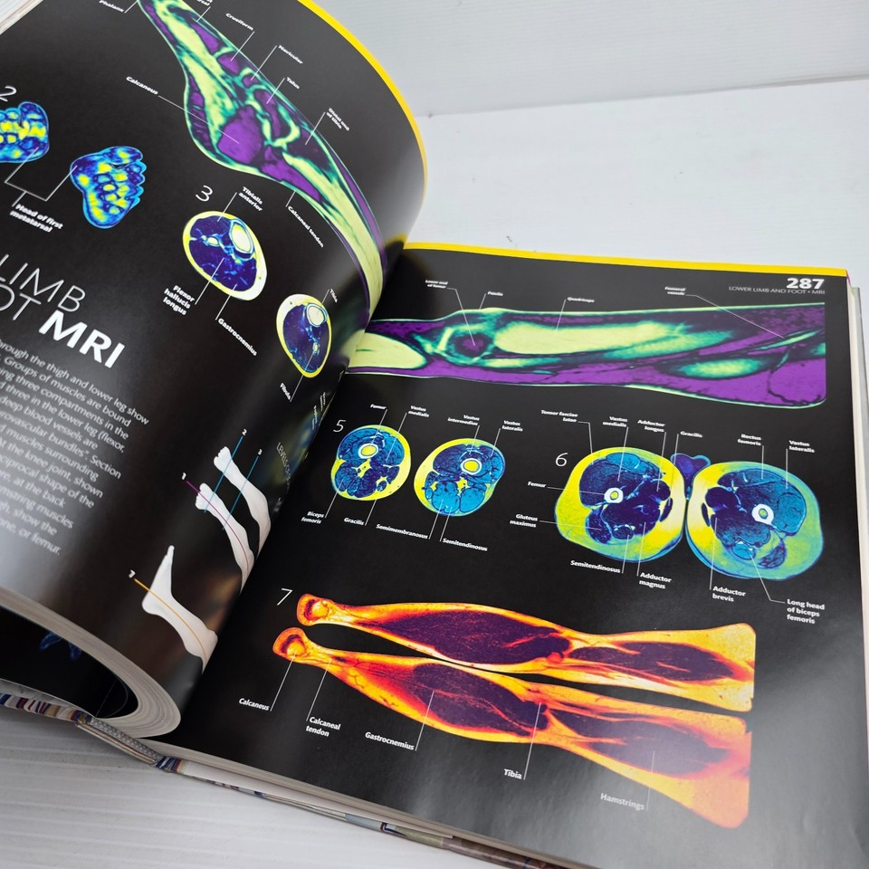 The Complete Human Body: The Definitive Visual Guide by Dr Alice ...