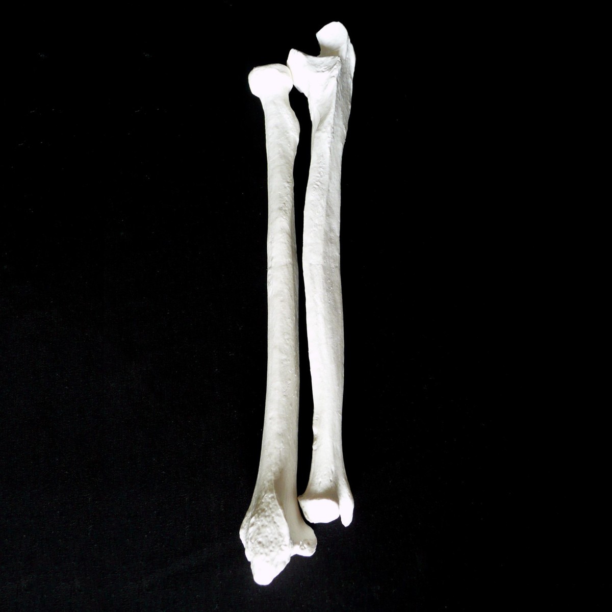 Human Radius Bone Human Anatomy Scientific Illustrations Radius Or