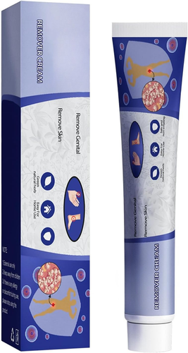 STRONG SKIN TAG REMOVER Cream NATURAL TREATMENT MOLES WARTS and TAGS ...