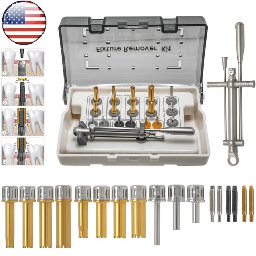 US Universal Implant Fixture Screw Remover Kits Neobiotech SR Repair ...