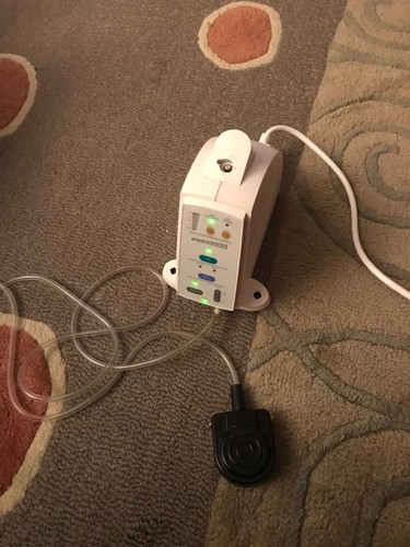 The Wand STA Single Tooth Anesthesia System STA-5110 by Milestone ...