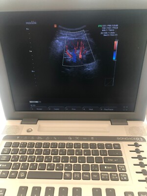 Samsung Medison Sonoace R3 Portable Ultrasound with LN5-12/40 vascular ...