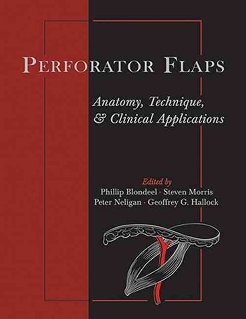 Perforator Flaps: Anatomy, Technique, & Clinical Applications by Peter ...