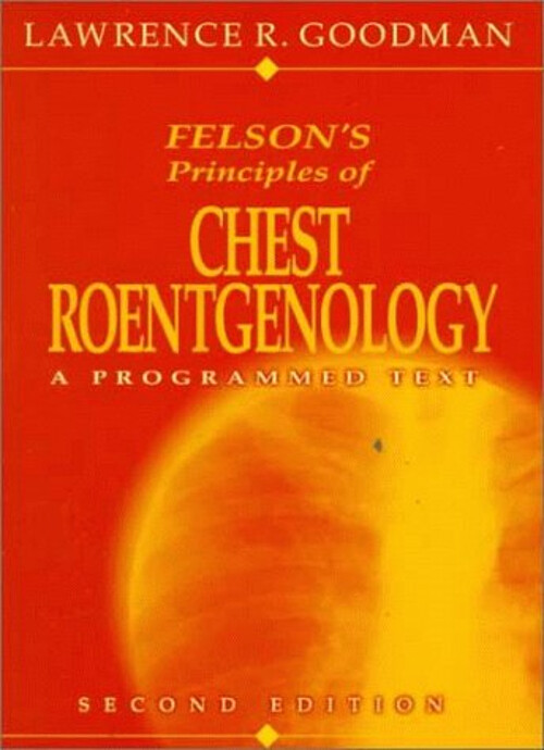 Felson's Principles of Chest Roentgenology : A Programmed Text by ...