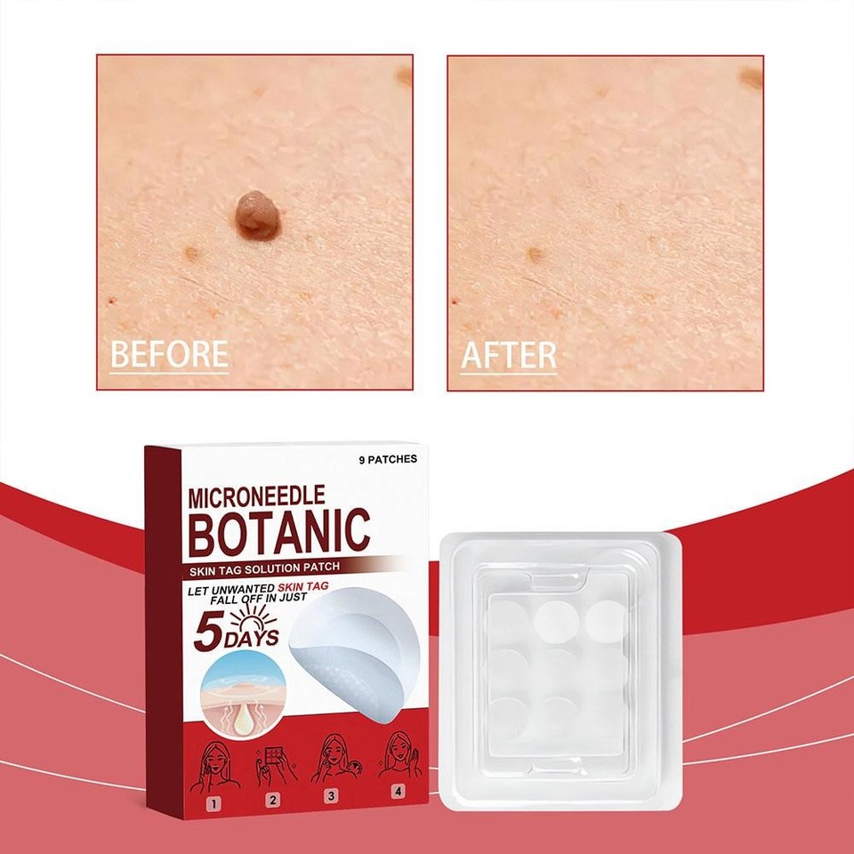 MICRONEEDLE BOTANIC Skin Tag & Acne Patch Skin Tag Remover Patches 9Pcs ...