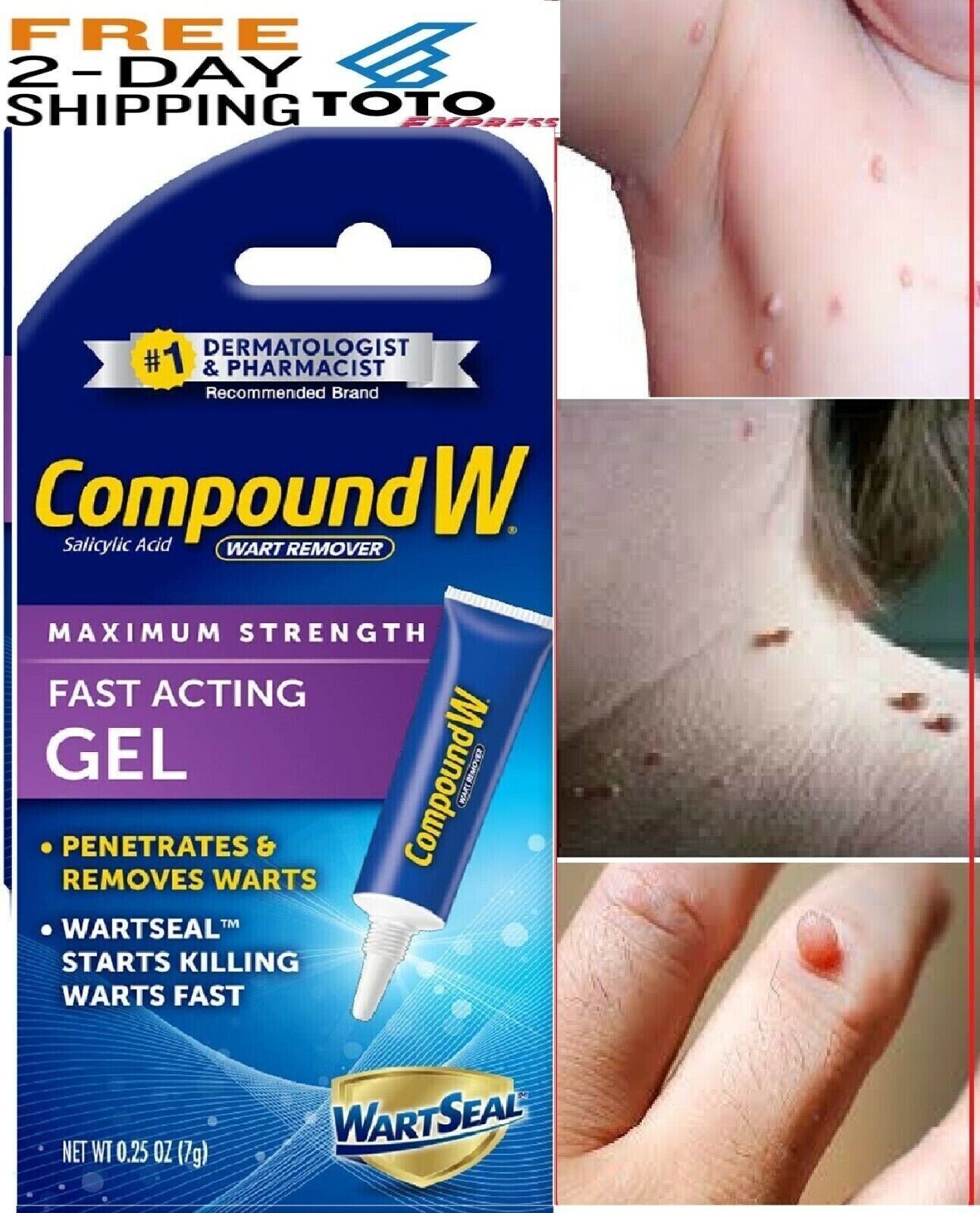 Tratamiento Removedor De Verrugas SIN DOLOR Eficaz Elimina Verrugas ...