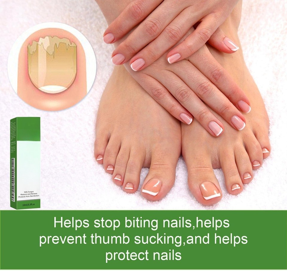 Nailshield Anti Fungal Stick,Monsalife Nail Shield Anti Fungal Stick ...