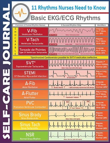 Self-care Journal: Nurse basic ekg ecg rhythms Invest 5 minut... by ...