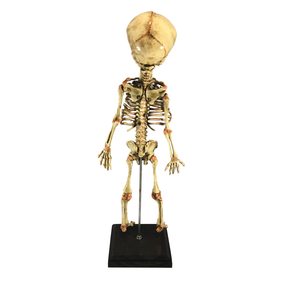 Aged Fetus Skeleton Medical Specimen Display Oddity Skull Bone ...