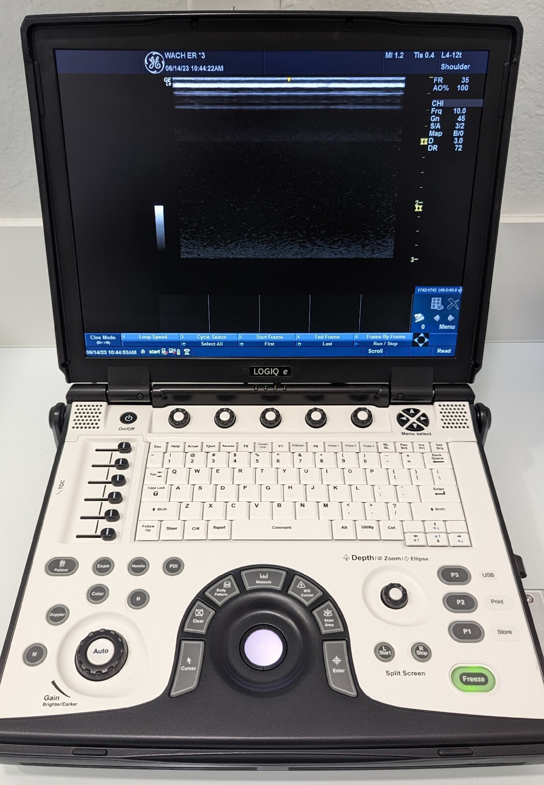 GE LOGIQ E NEXTGEN R.9 W/ 1 TRANSDUCER / 1 YEAR WARRANTY / DEMO ...