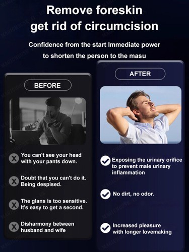 Male Foreskin Gel External Care Nourishes Penis And Removes Excess Silk ...