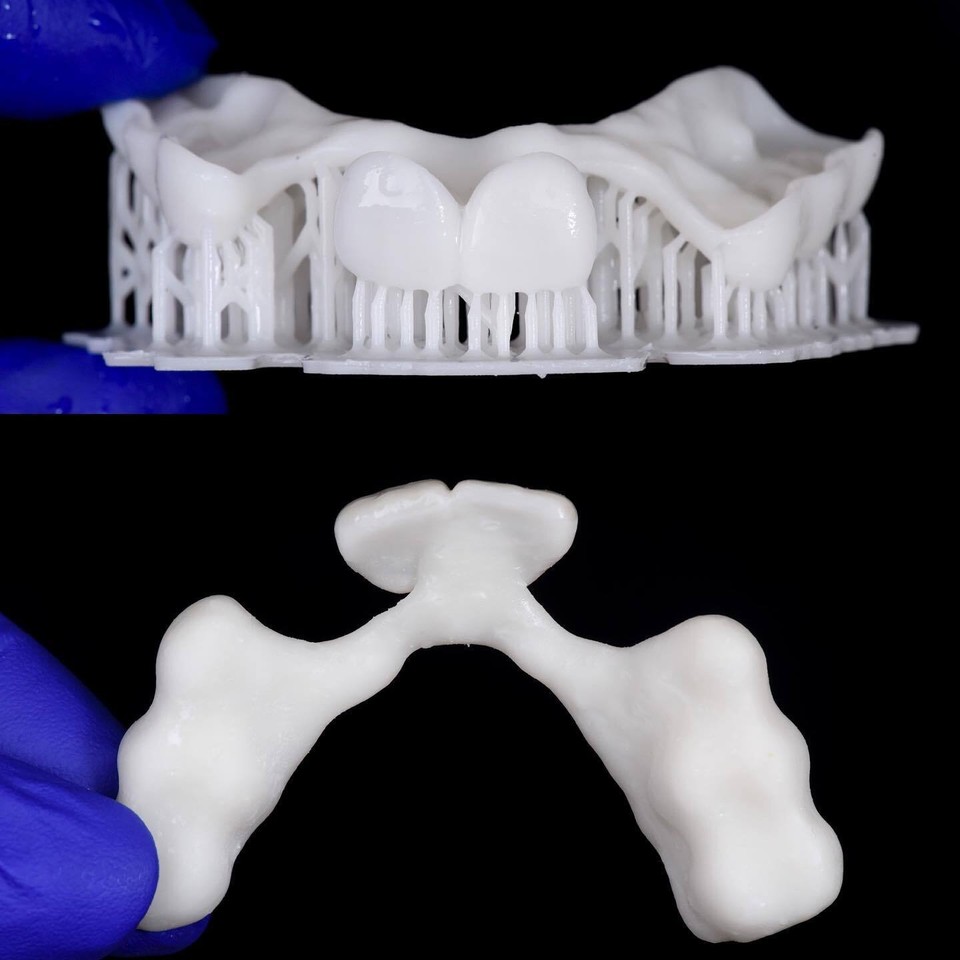 DLP SLA LCD 3d printer temporary teeth resin .. | eBay