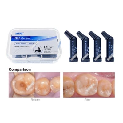 Dental Compules Unidose Composite Resin Capsules Light Cure Fit TPH ...