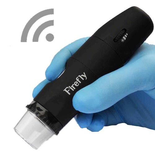 Firefly DE350 Handheld Digital Wireless Polarized Dermatoscope ...