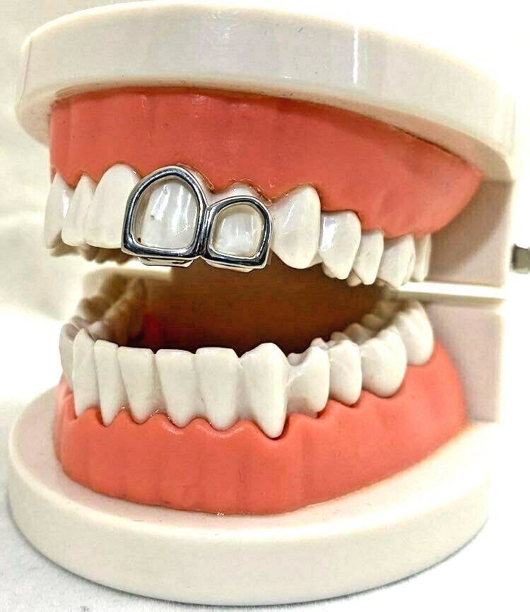 Platinum Teeth Caps Metal Porcelain Crowns Dental Centre In Turkey