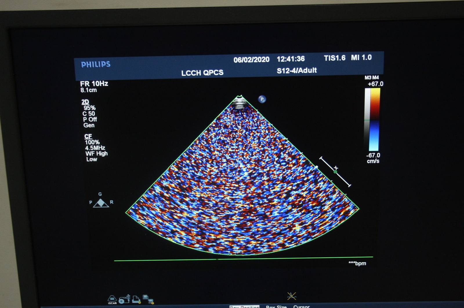 Philips S12-4 Sector Array Ultrasound Transducer Probe for IU22 IE33 ...