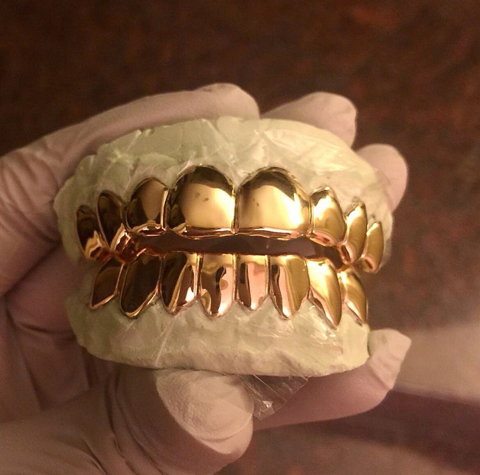 MA CUSTOM 6/6 14k REAL SOLID GOLD PERM CUT GRILLZ | eBay