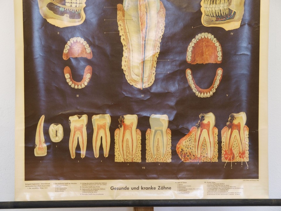Teeth Dentist Dentures Incisors Teeth Caries Dental~1953 Mural 83x114c ...