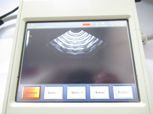 ECHOSON PINIT PORTABLE COLOUR MOBILE ULTRASOUND BLADDER SCANNER ...