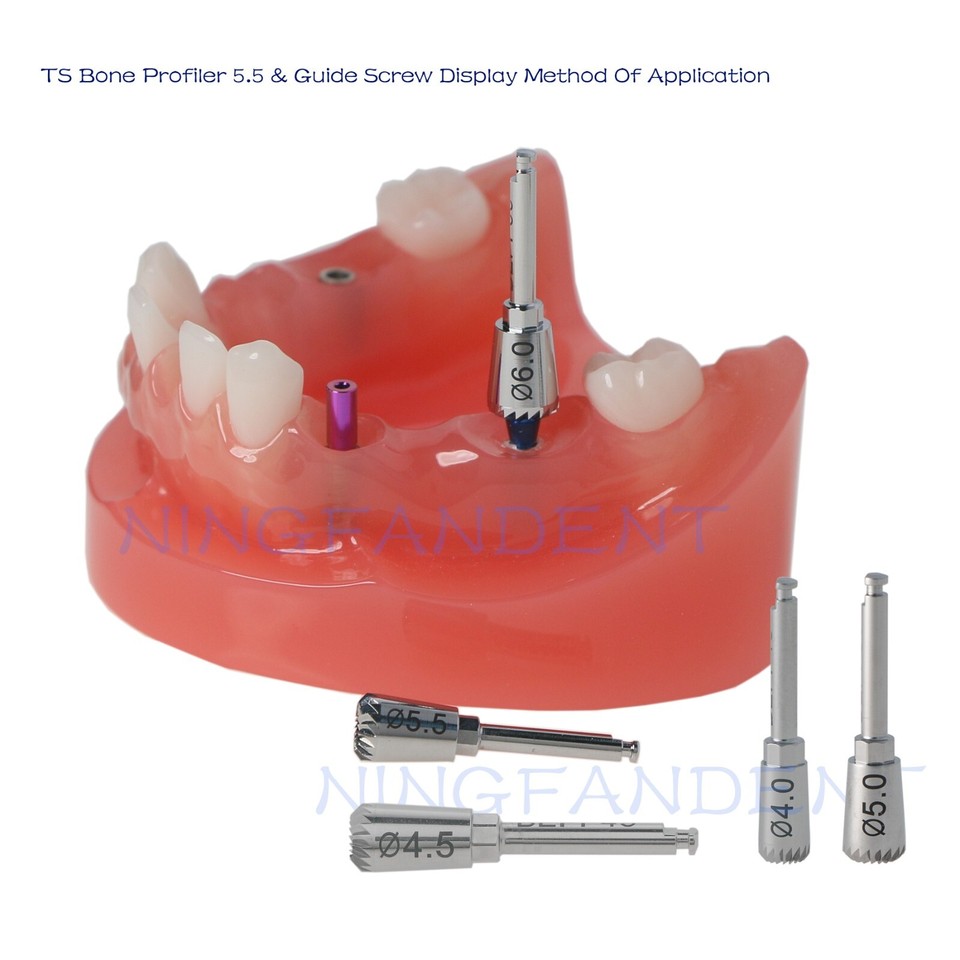 Implant Prosthetic Kit For Hiossen Osstem,Dental TS Bone Profiler ...
