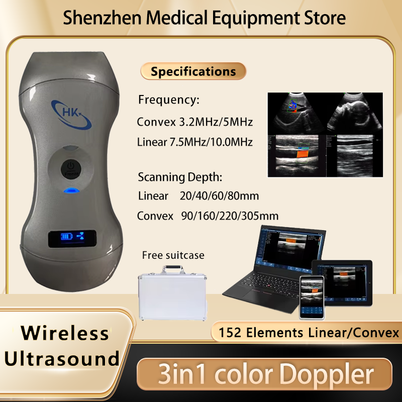 Portable Wireless Ultrasound Probe Scanner Support iOS Android Windows ...