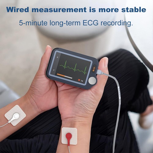 Wellue EX Multi-user ECG Monitor with AI Analysis 30s/60s/5 mins EKG ...