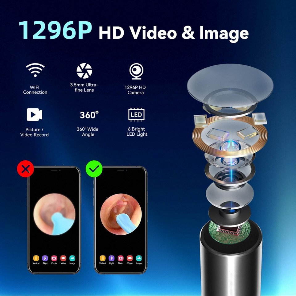 Ear Wax Removal Smart Visual Ear Cleaner with Otoscope 1296P HD Camera ...