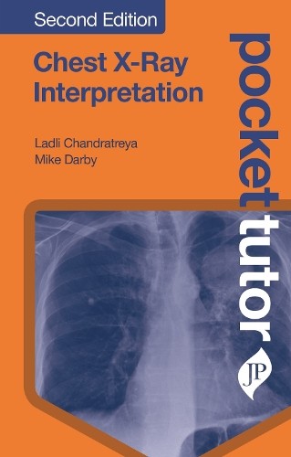 Mike Darby Ladli Chand Pocket Tutor Chest X-Ray Interpr (Paperback) (UK ...